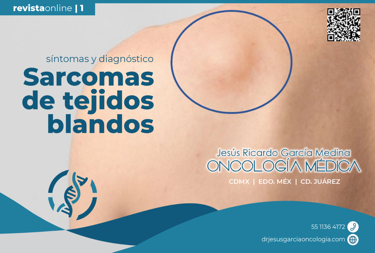 Sarcomas de tejidos blandos - Dr. Jesús Ricardo García Medina