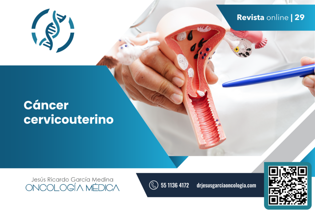 Cáncer Cervicouterino - Dr. Jesús Ricardo García Medina