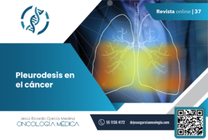 Pleurodesis En El Cáncer - Dr. Jesús Ricardo García Medina